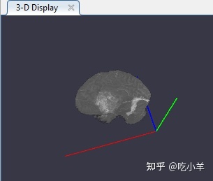 MATLAB图像处理：90：使用 Volume Segmenter 创建二进制蒙版