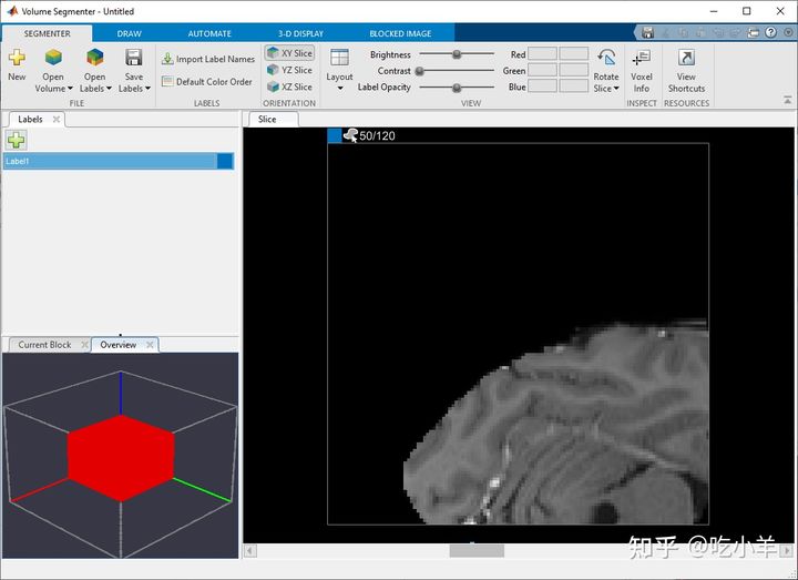 MATLAB图像处理：92：使用 Volume Segmenter 处理被阻止的图像