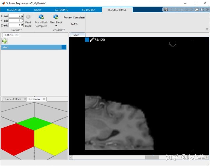 MATLAB图像处理：92：使用 Volume Segmenter 处理被阻止的图像