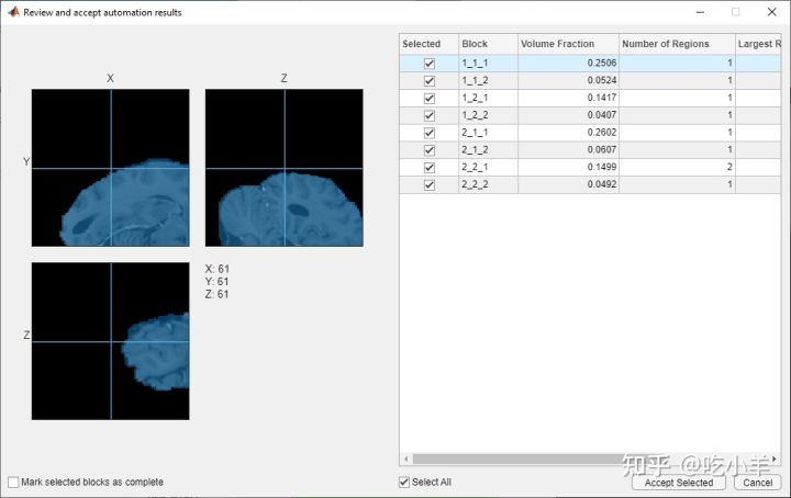 MATLAB图像处理：92：使用 Volume Segmenter 处理被阻止的图像